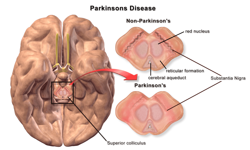 Subthalamus | Facts, Anatomy, Function, Position & Summary