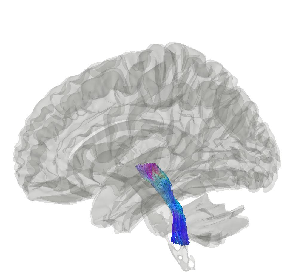 The Pons | Facts, Position In Brain, Summary & Function