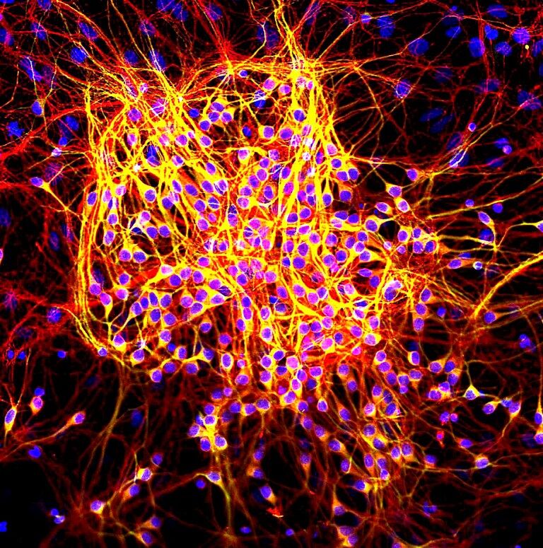 Rubrospinal Tract | Facts, Location, Physiology, Roles & Summary